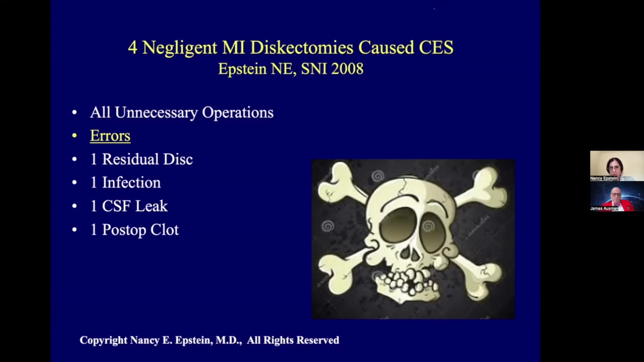 Epsetin CES Part 2 Malpractice Lumbar Surgery